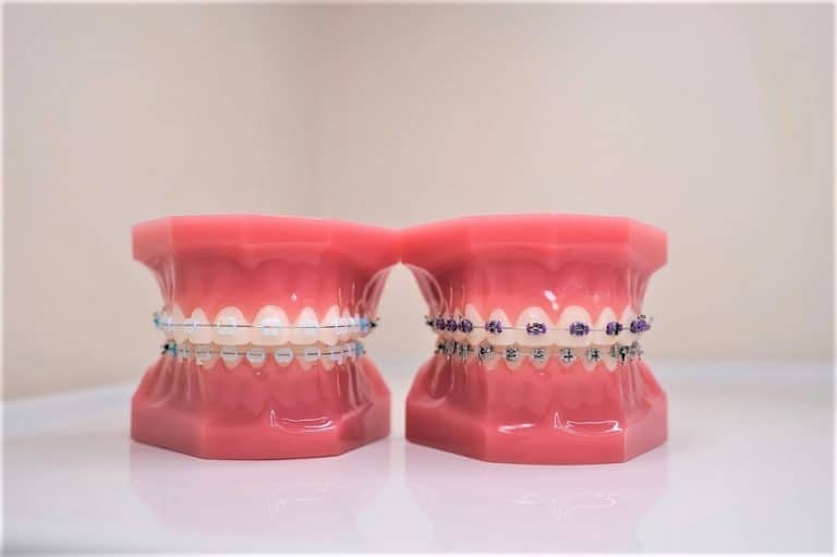 Discover the Best Invisible Braces for a Confident Smile