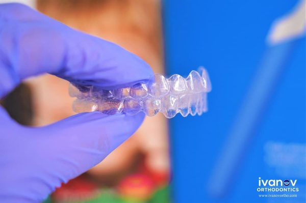 Power Chain Braces for a Better Smile | Ivanov Orthodontics