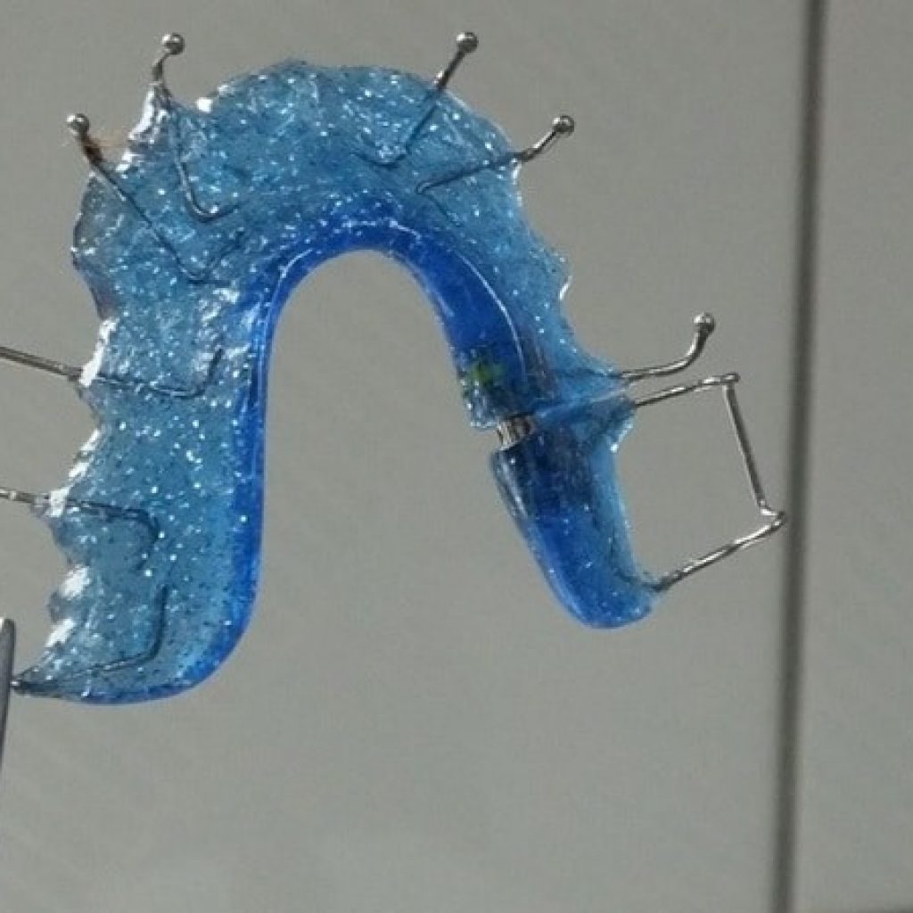 How Much Do Braces Cost For Kids | How Much Are Braces For Kids