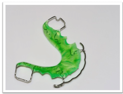 How Much Are Retainers Cost? - Ivanov Orthodontist
